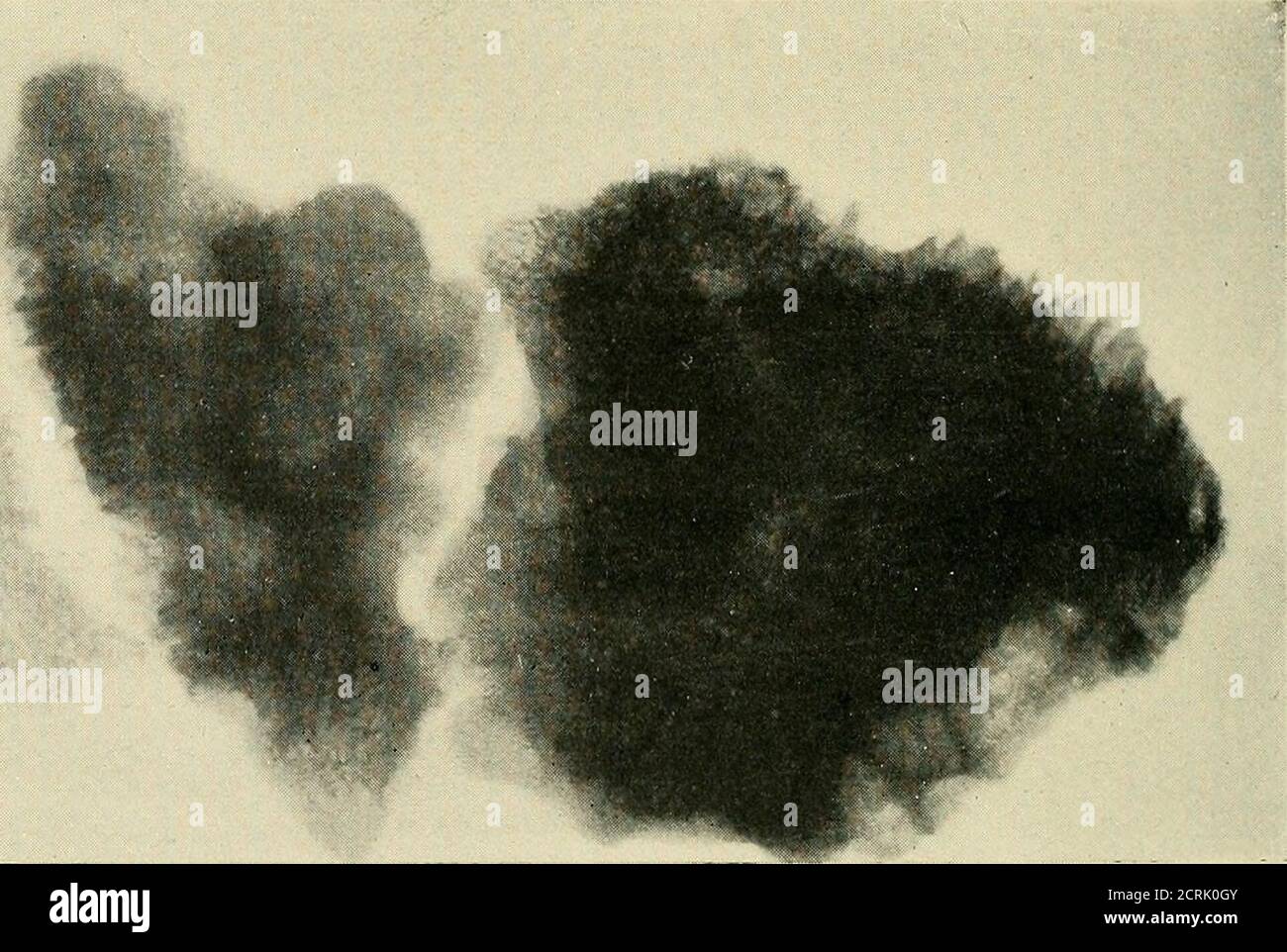 Cartilaginous joints hi-res stock photography and images - Alamy