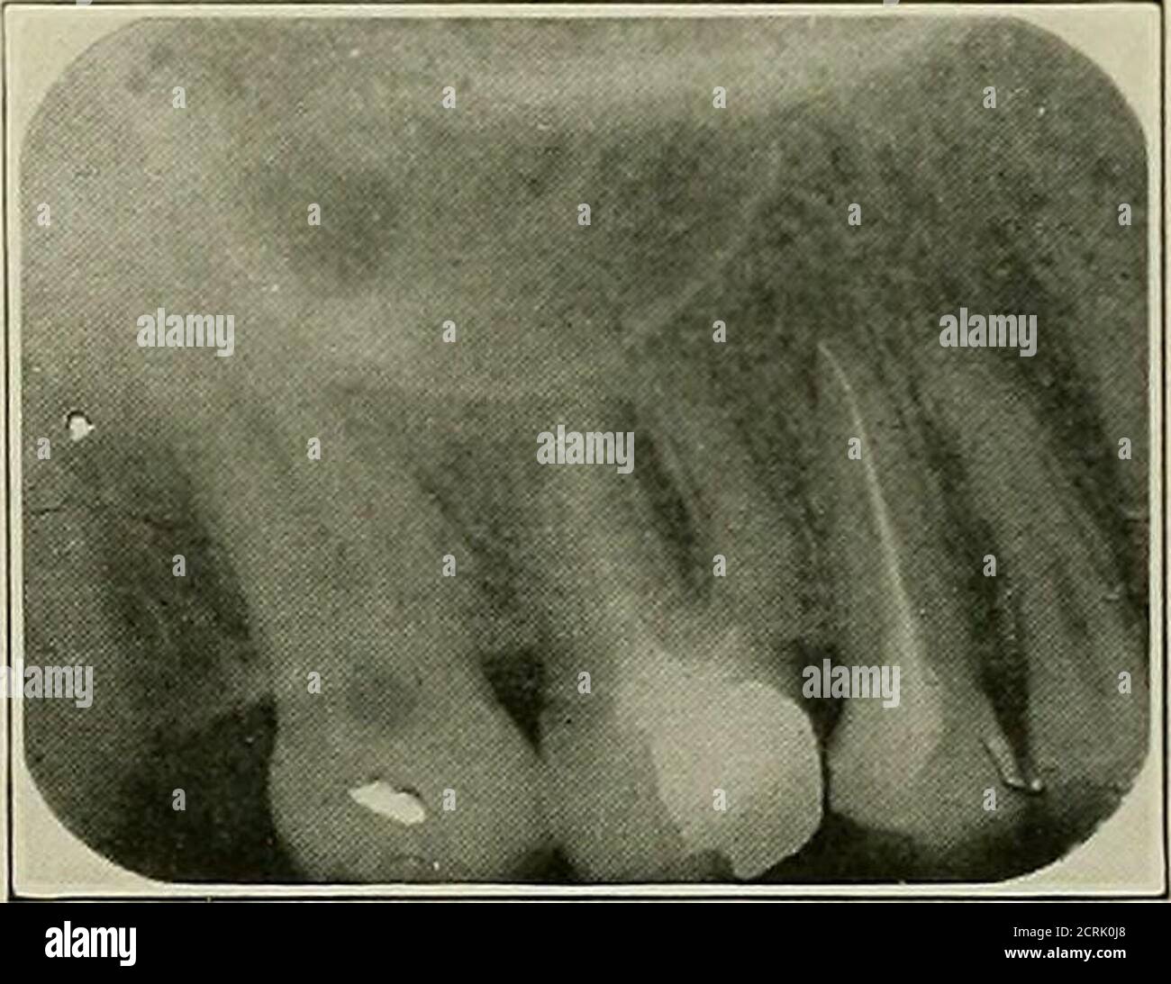 . Dental and oral radiography; a textbook for students and ...
