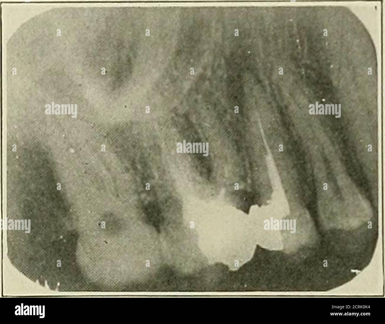 . Dental and oral radiography; a textbook for students and ...