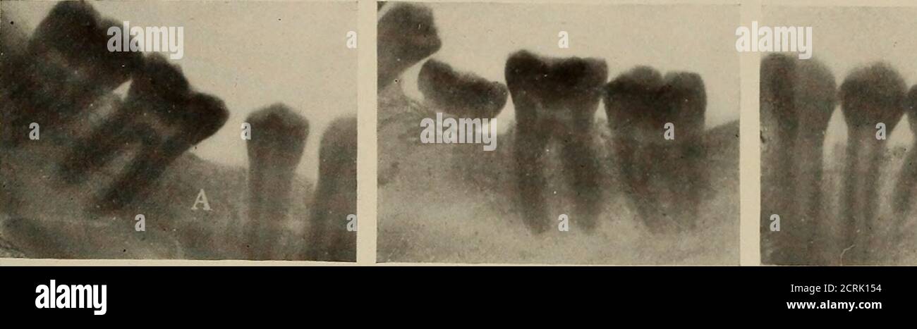 . Living anatomy and pathology; . ary lateral incisor. E. Left upper ...