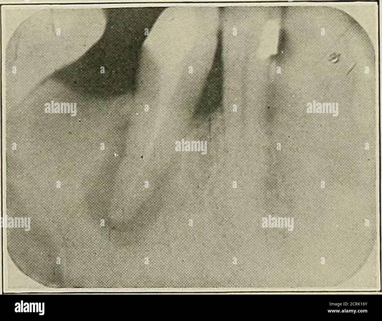 Evidence of alterations hi-res stock photography and images - Alamy