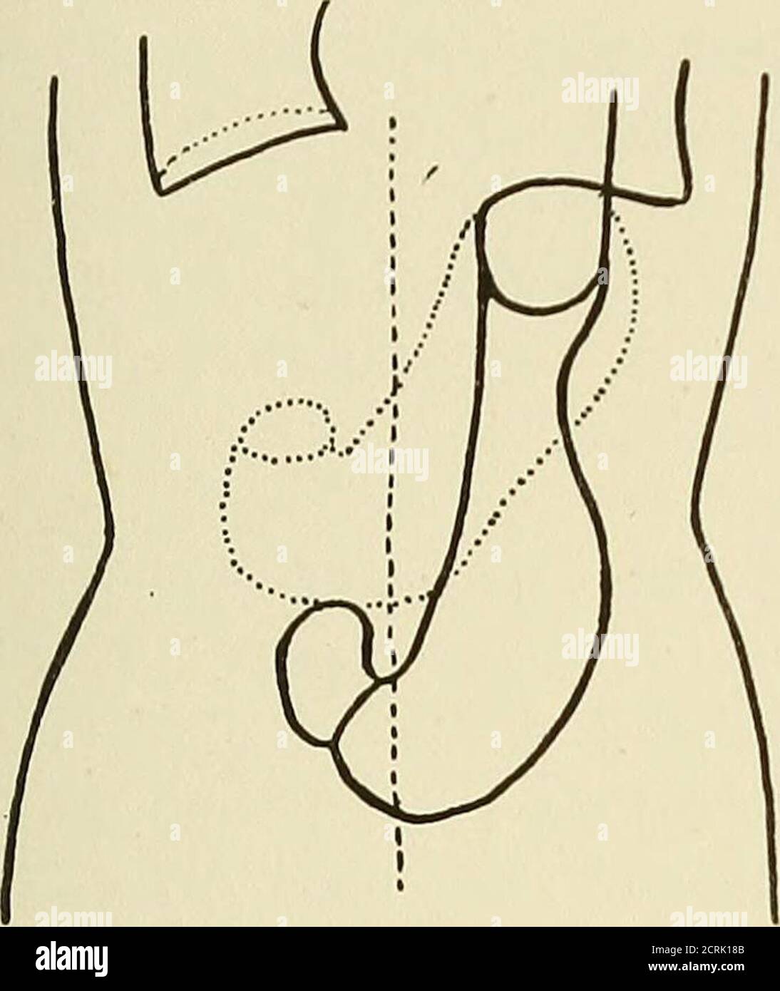 . Radiography, x-ray therapeutics and radium therapy . PLATE XLV ...