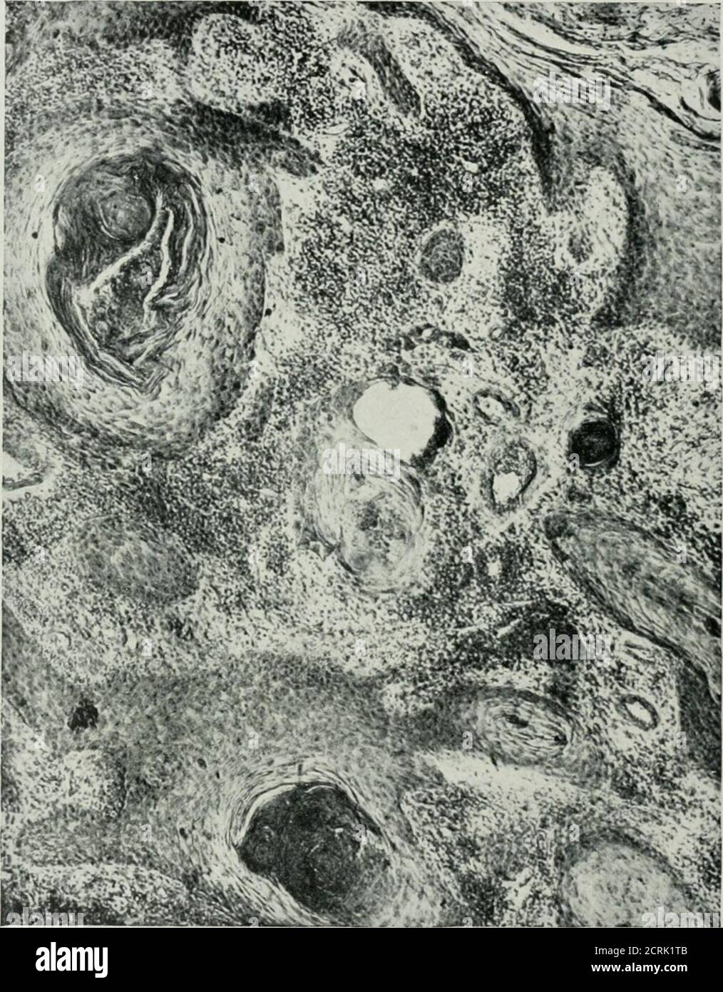 . The Roentgen rays in medicine and surgery as an aid in diagnosis and ...