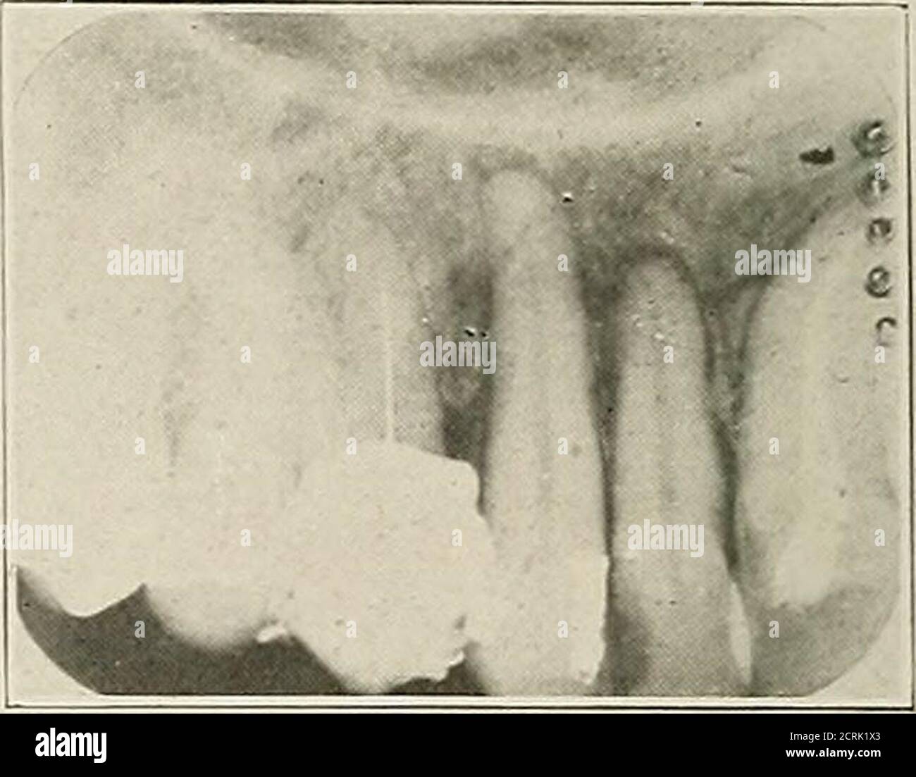 . Interpretation of dental and maxillary roentgenograms . Fig. SO. Fig ...