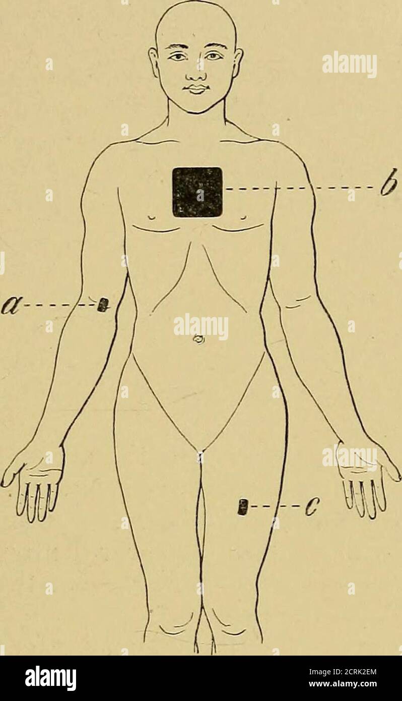 . Electricity : its medical and surgical applications, including ...