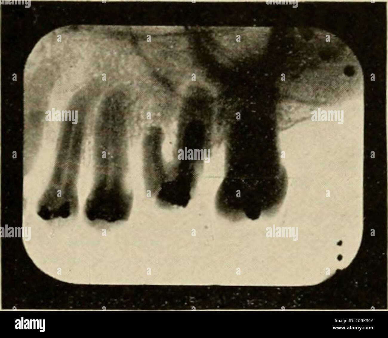 . Elementary and dental radiography / by Howard Riley Raper . ontaining ...
