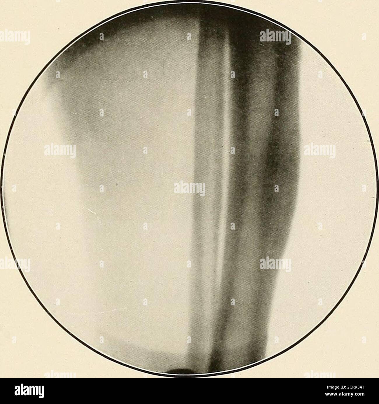 Shadow and bone mal hi-res stock photography and images - Alamy