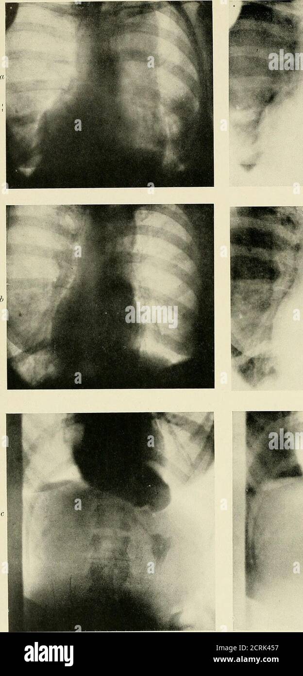 Radiographic interpretation hi-res stock photography and images - Alamy