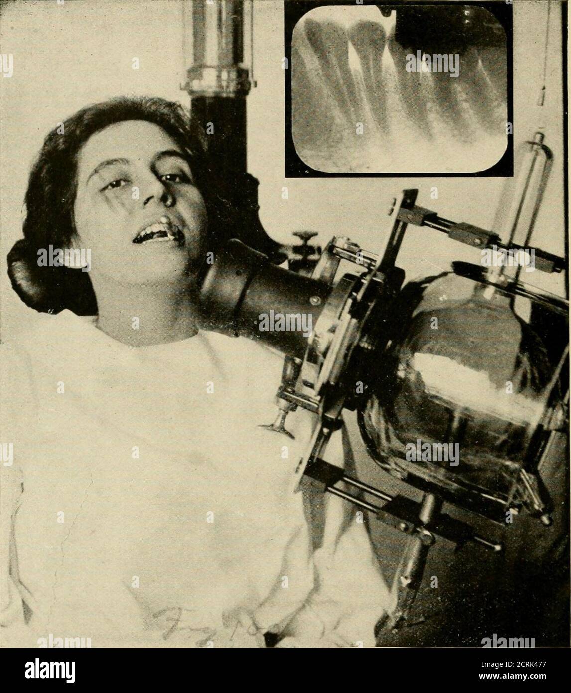 . Elementary and dental radiography / by Howard Riley Raper . Fig. 99 ...