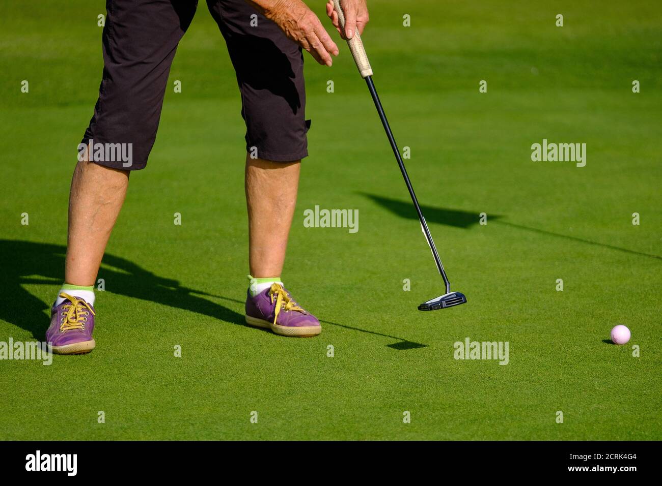 Club foot hi-res stock photography and images - Alamy