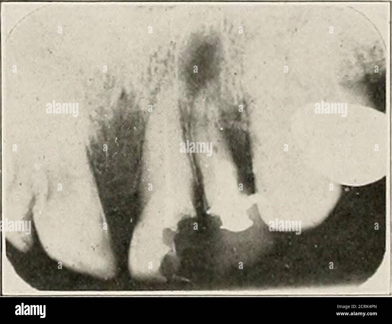 Pre maxillary bone hi-res stock photography and images - Alamy