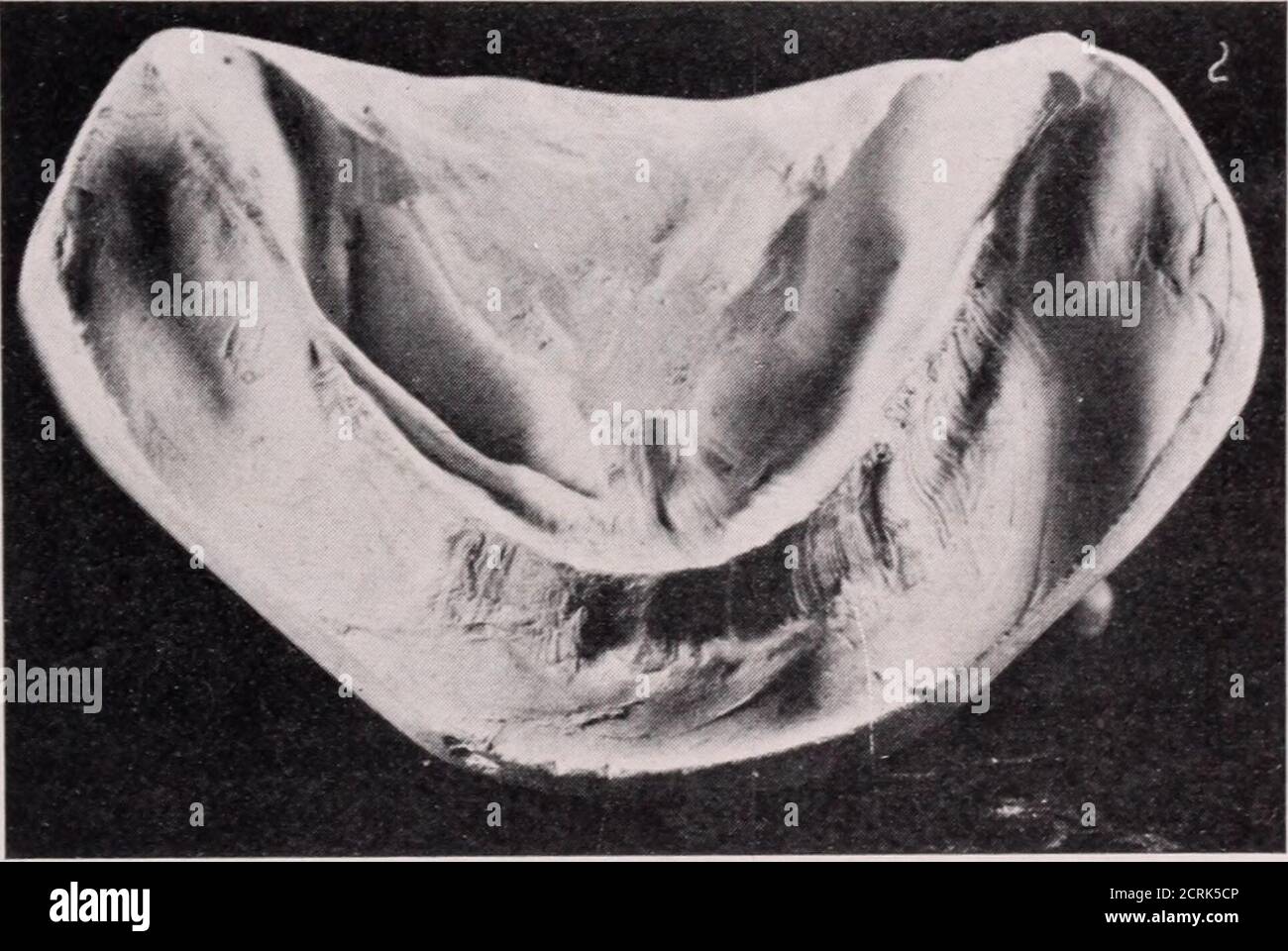 . Journal of radiology . Page Eighteen Pathology of mouth—shearer Figs ...