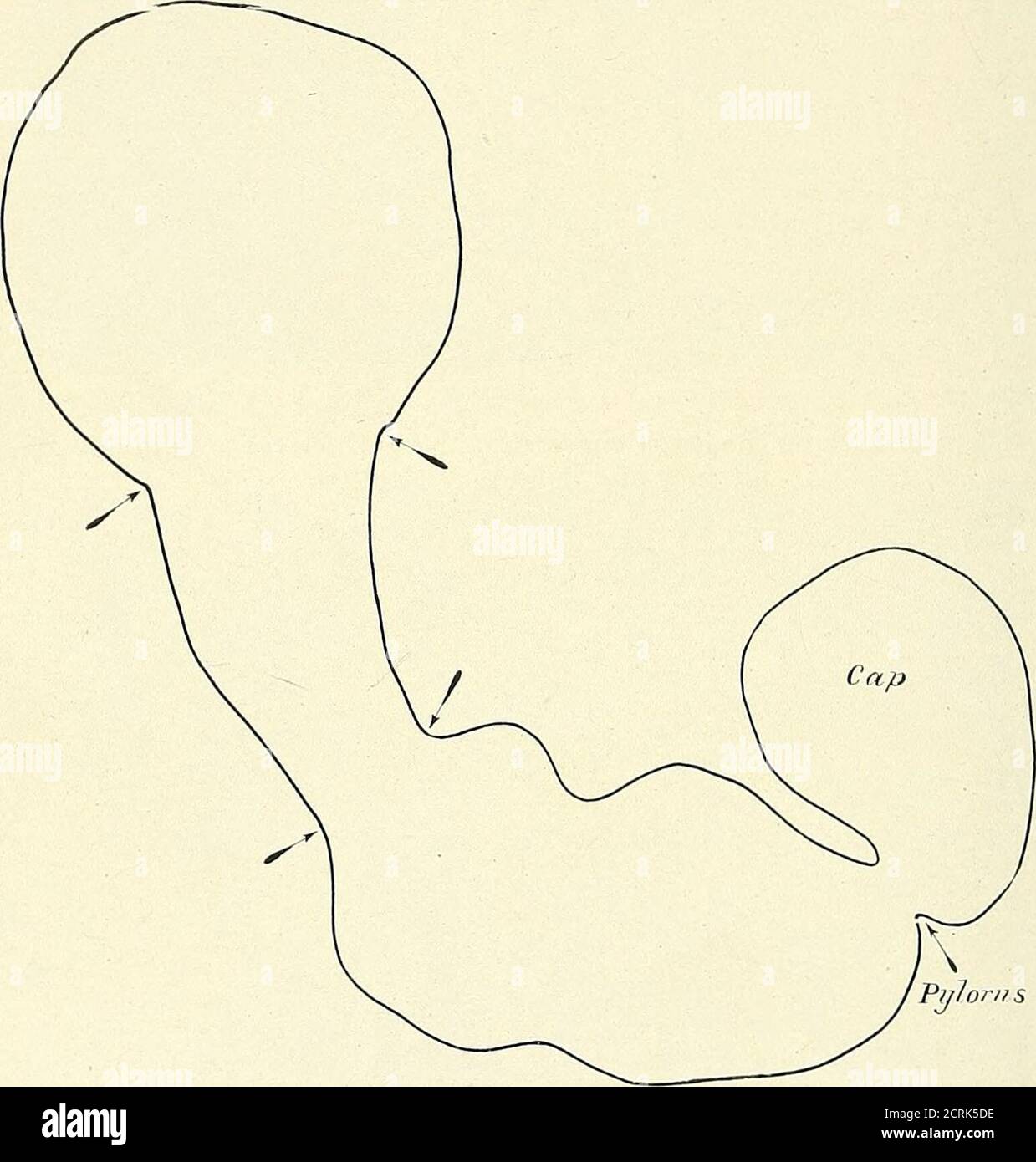 Intestinal motility hi-res stock photography and images - Alamy