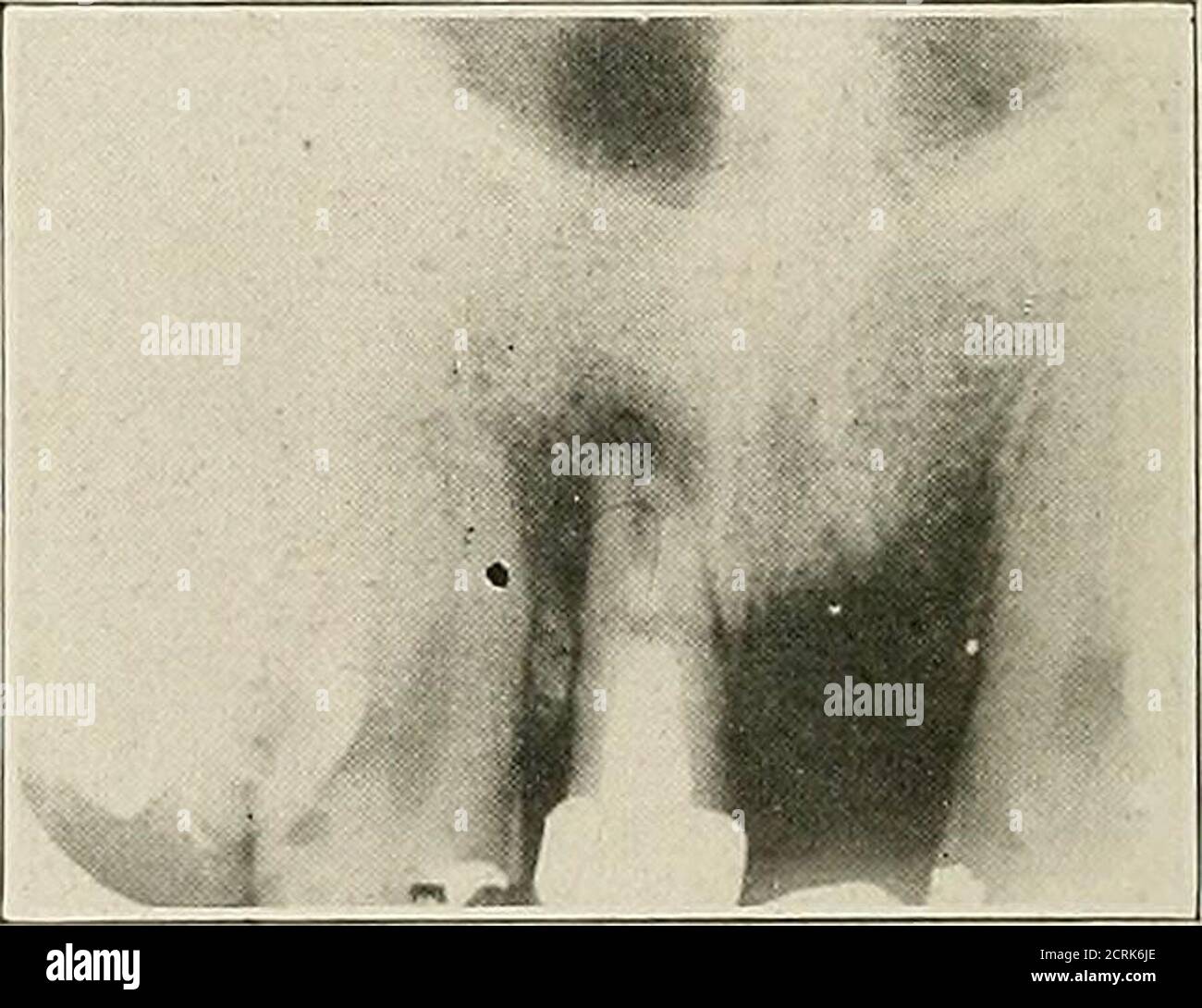 Turbinates hi-res stock photography and images - Alamy