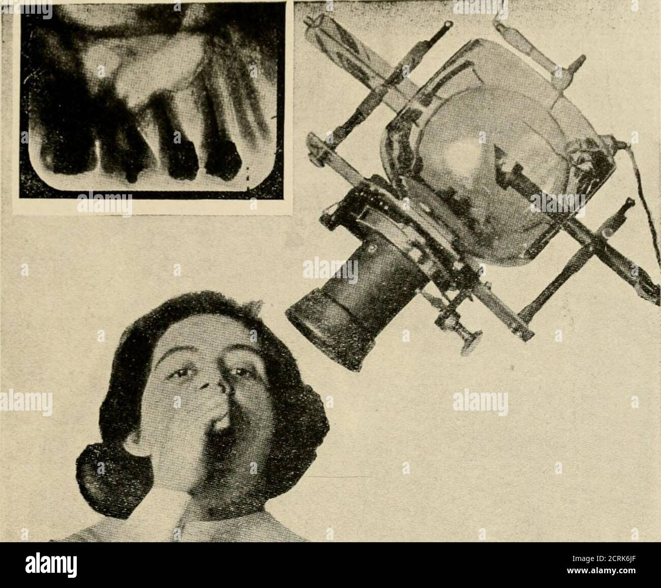 . Elementary and dental radiography / by Howard Riley Raper . Fig. 89 ...