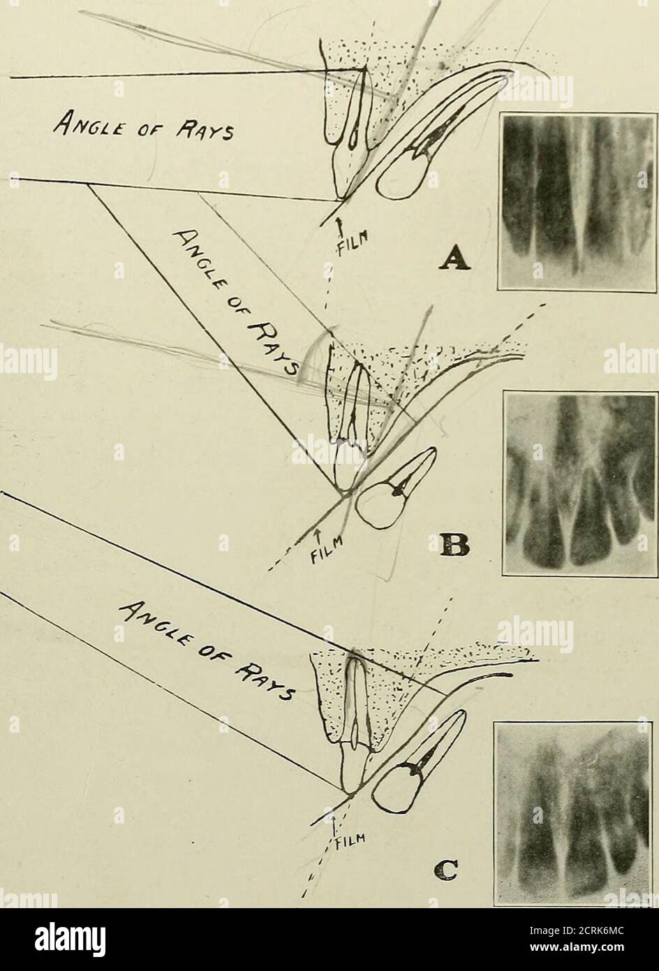 . Dental and oral radiography; a textbook for students and ...