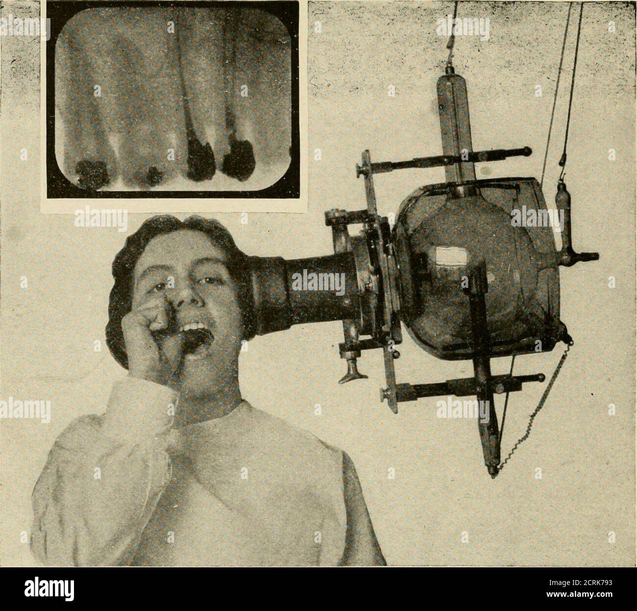 . Elementary and dental radiography / by Howard Riley Raper . Fig. 87 ...