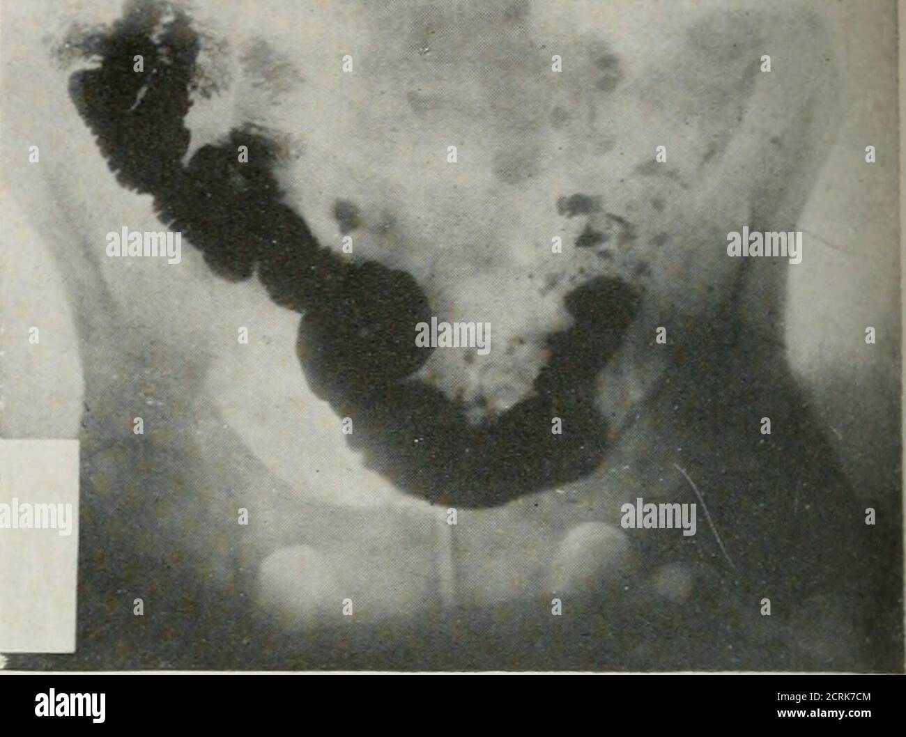 . The American journal of roentgenology, radium therapy and nuclear ...