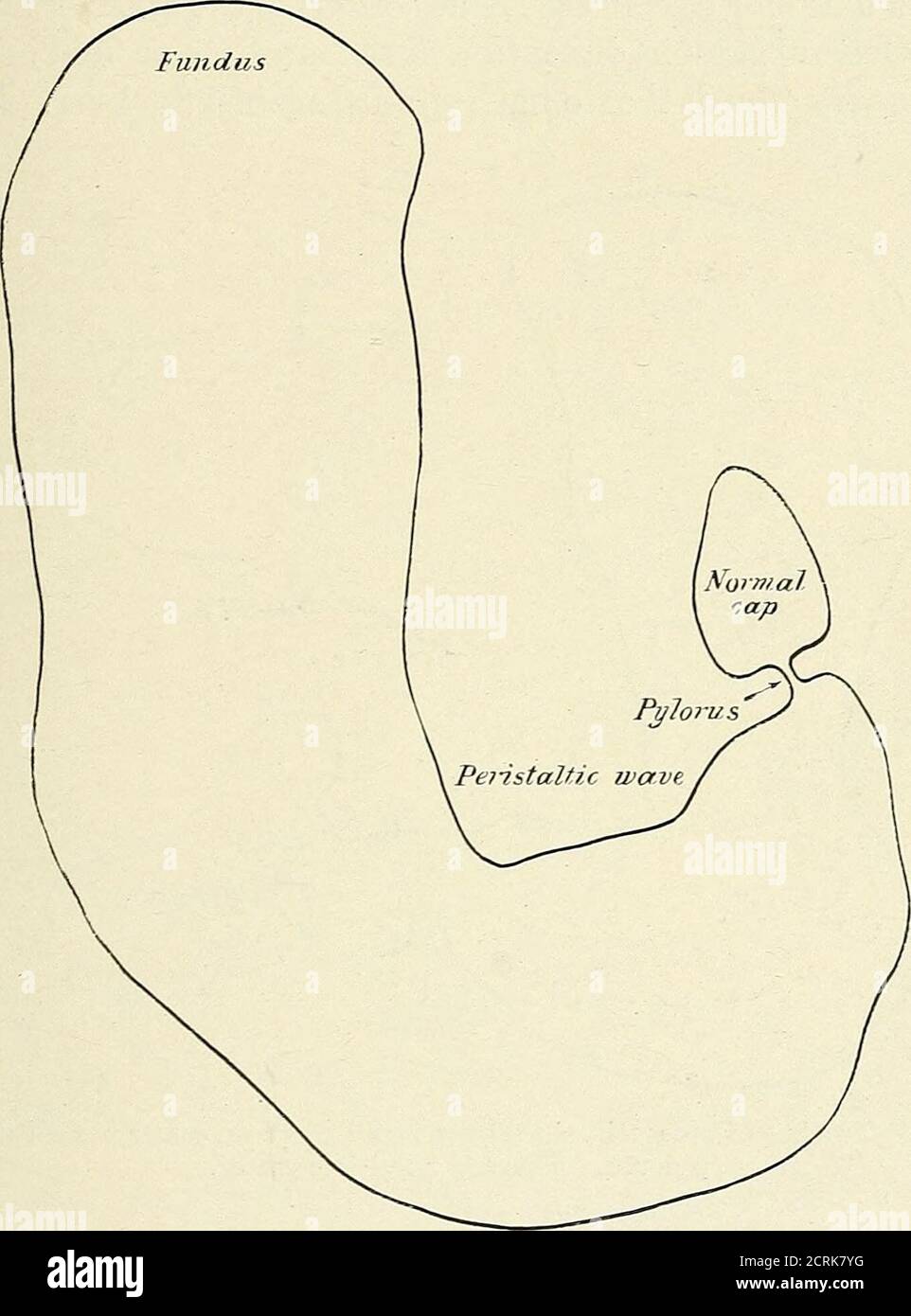 Curva normal hi-res stock photography and images - Alamy