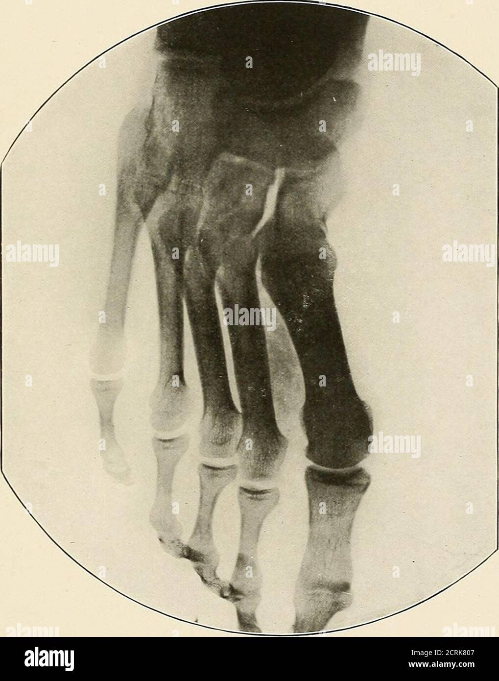 . A radiographic atlas of the pathologic changes of bones and joints ...