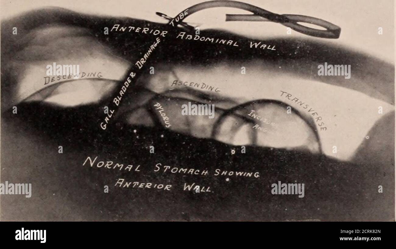 Murphy drip hi-res stock photography and images - Alamy