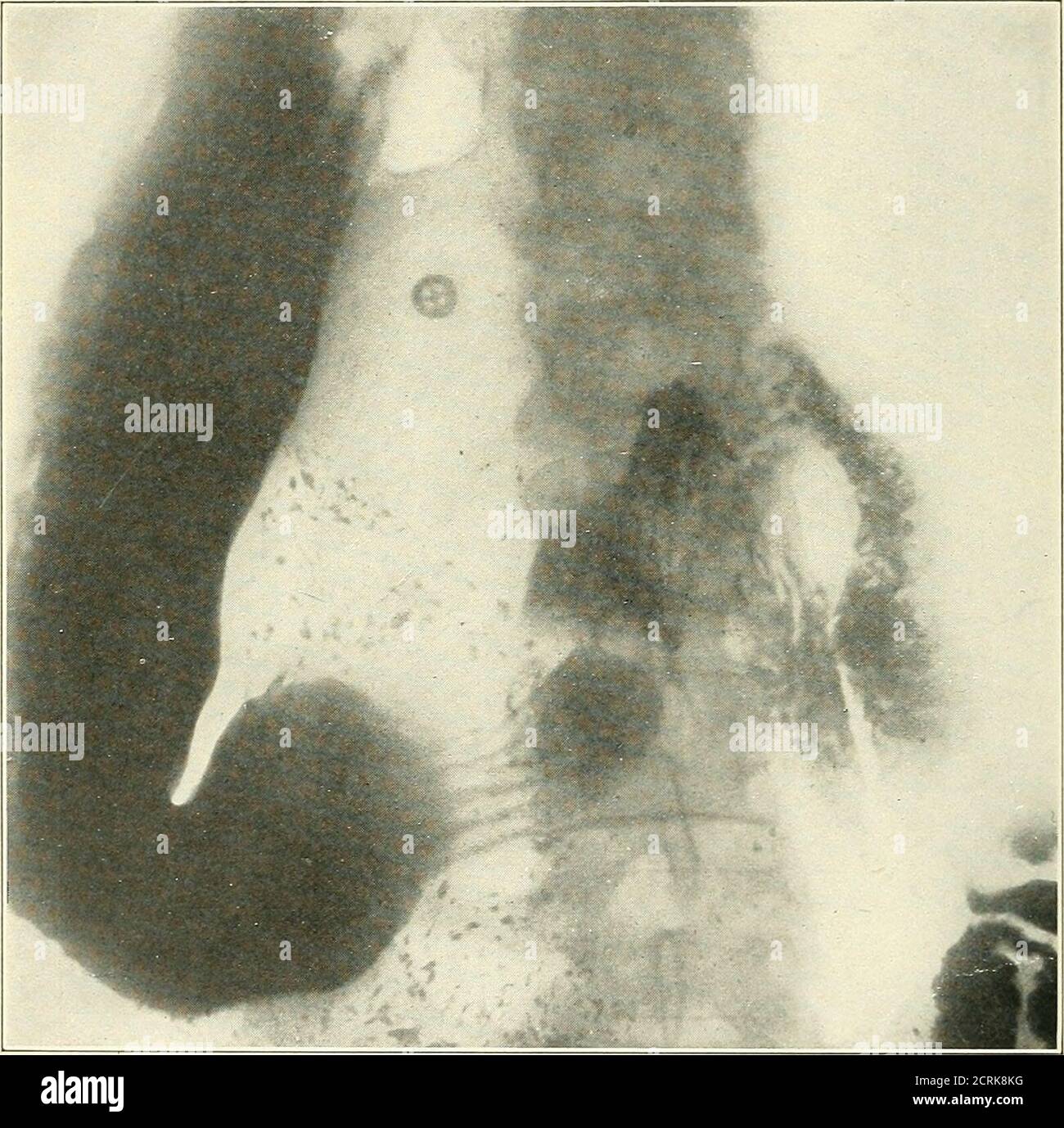 . Roentgen interpretation; a manual for students and practitioners ...