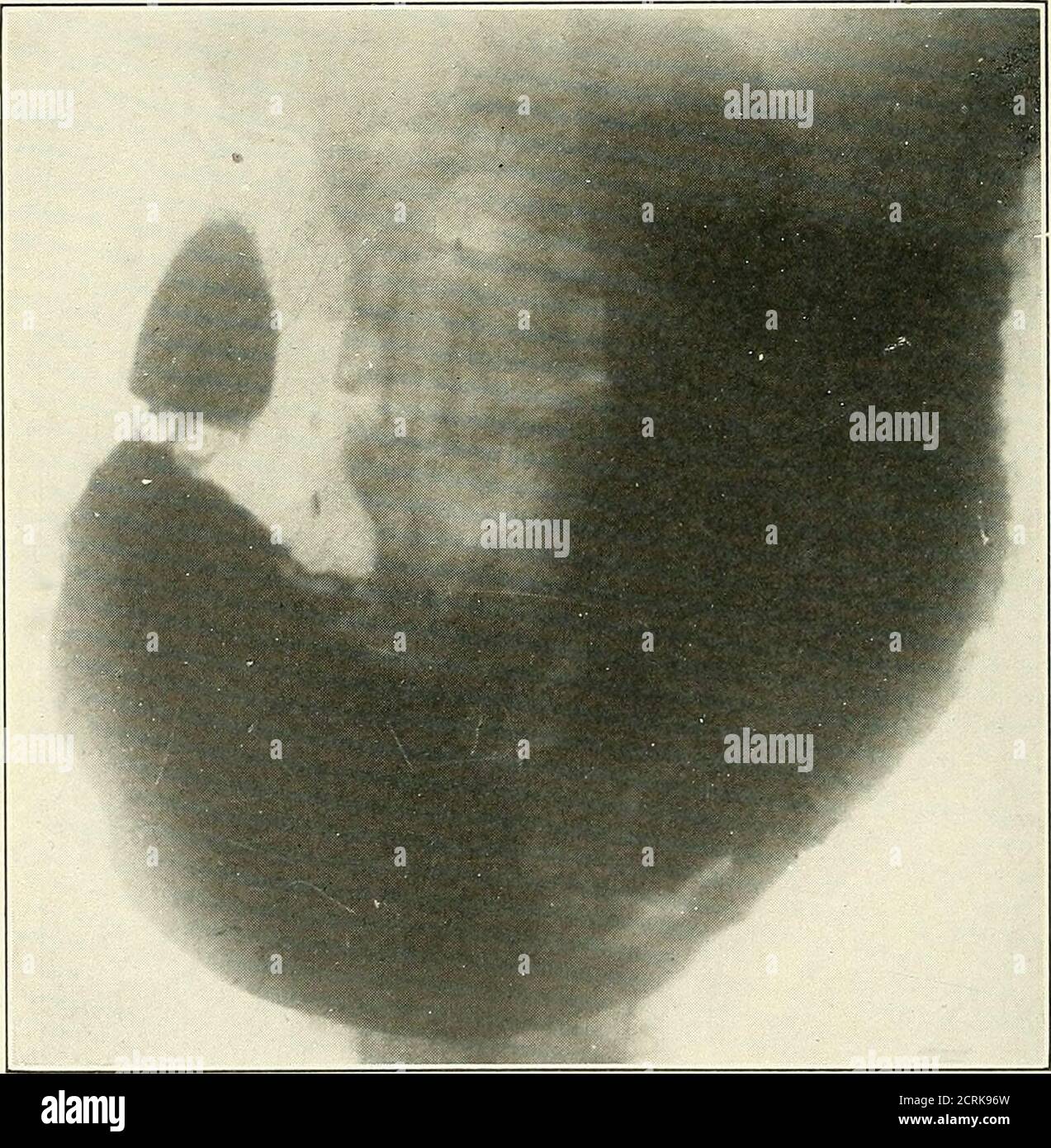 . Roentgen interpretation; a manual for students and practitioners ...