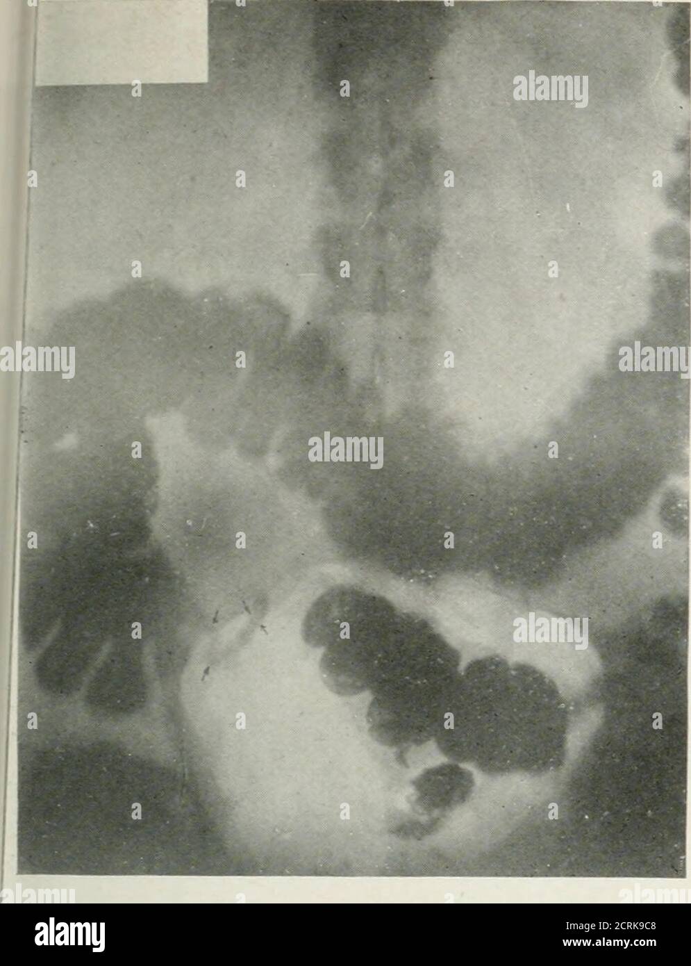 . The American journal of roentgenology, radium therapy and nuclear ...