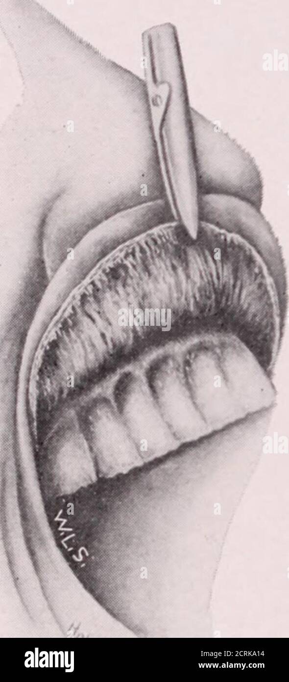 . Journal of radiology . root ends of the teeth. ably in alveolar ...
