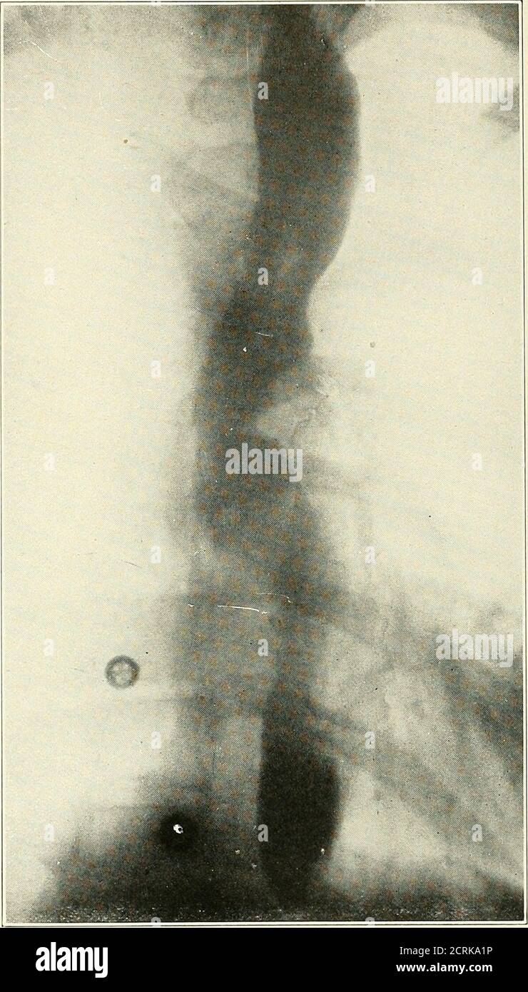 . Roentgen interpretation; a manual for students and practitioners ...