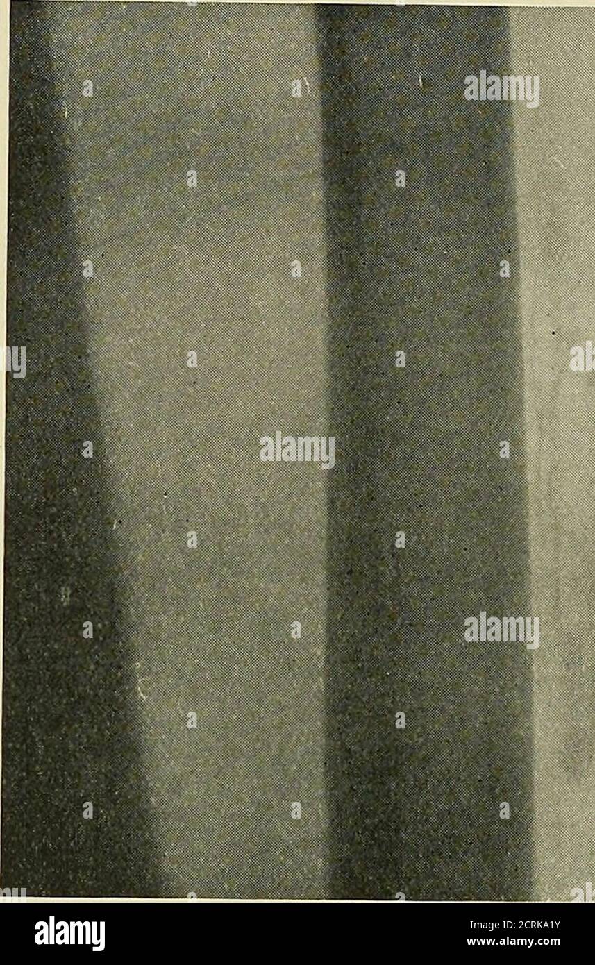 . Radiography, x-ray therapeutics and radium therapy . shaft of a long ...