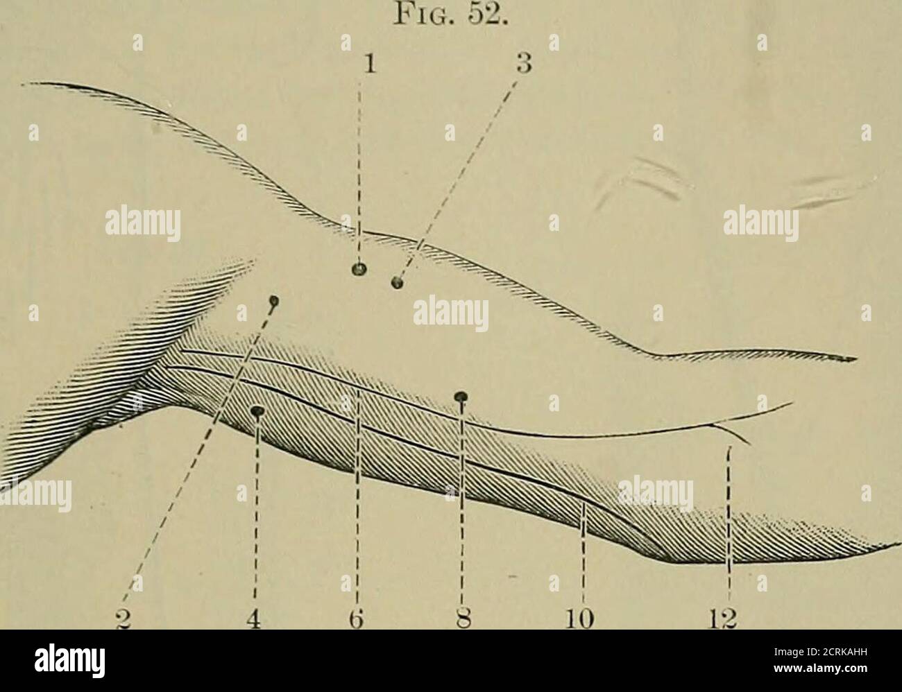 Cathodal hi-res stock photography and images - Alamy