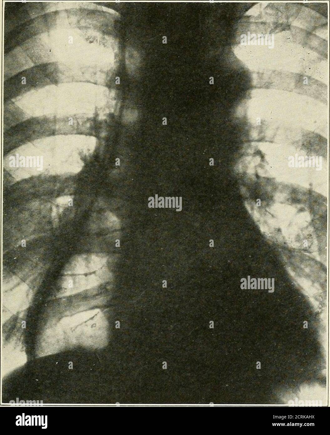 . Roentgen interpretation; a manual for students and practitioners ...