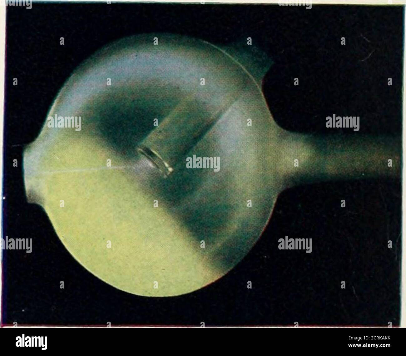 . Radiography, X-ray therapeutics and radium therapy Stock Photo - Alamy