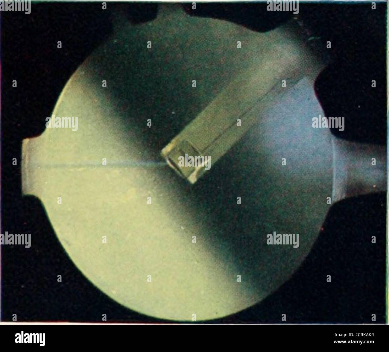 . Radiography, X-ray therapeutics and radium therapy Stock Photo - Alamy