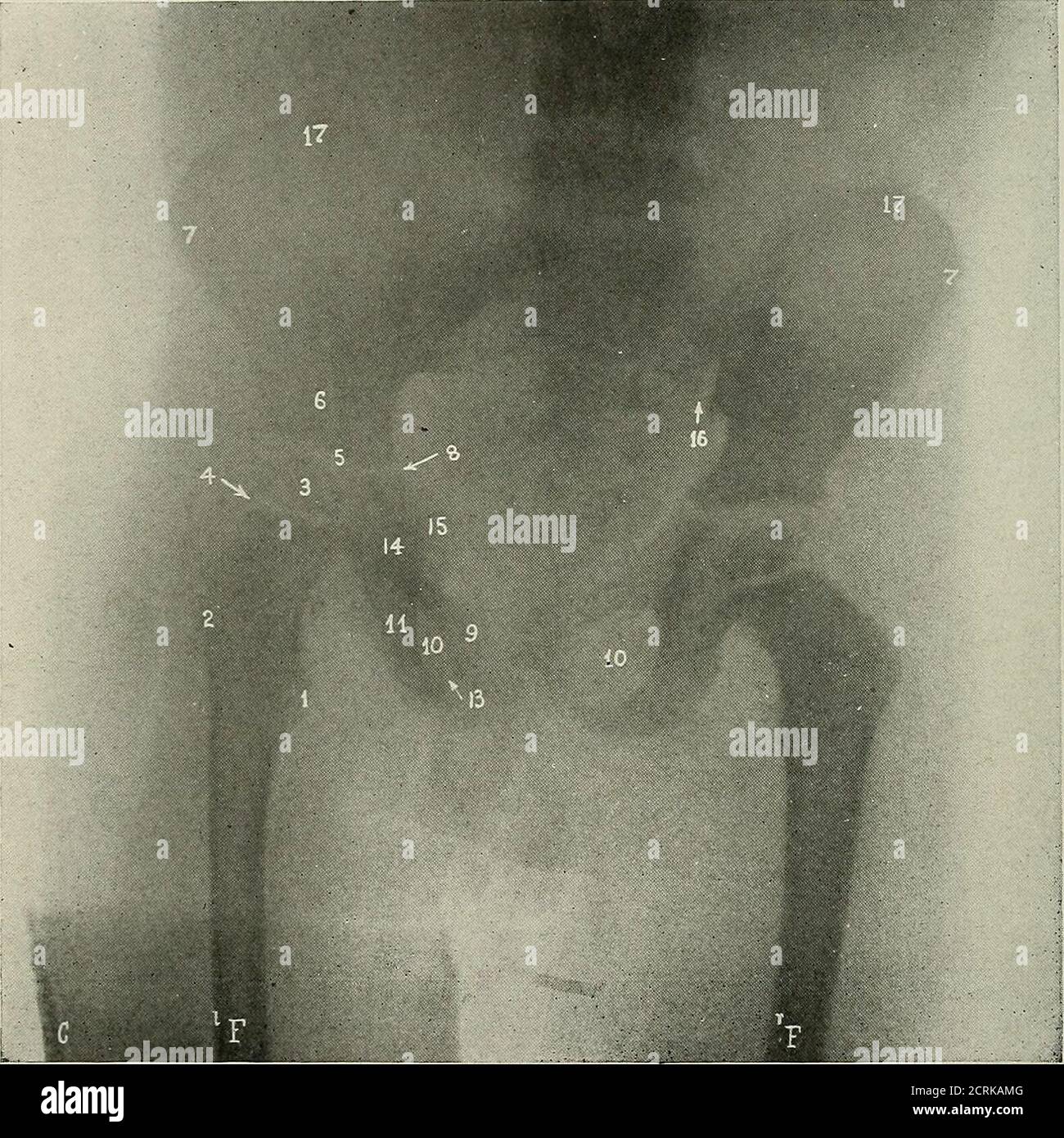 . Röntgen rays and electro-therapeutics : with chapters on radium and ...