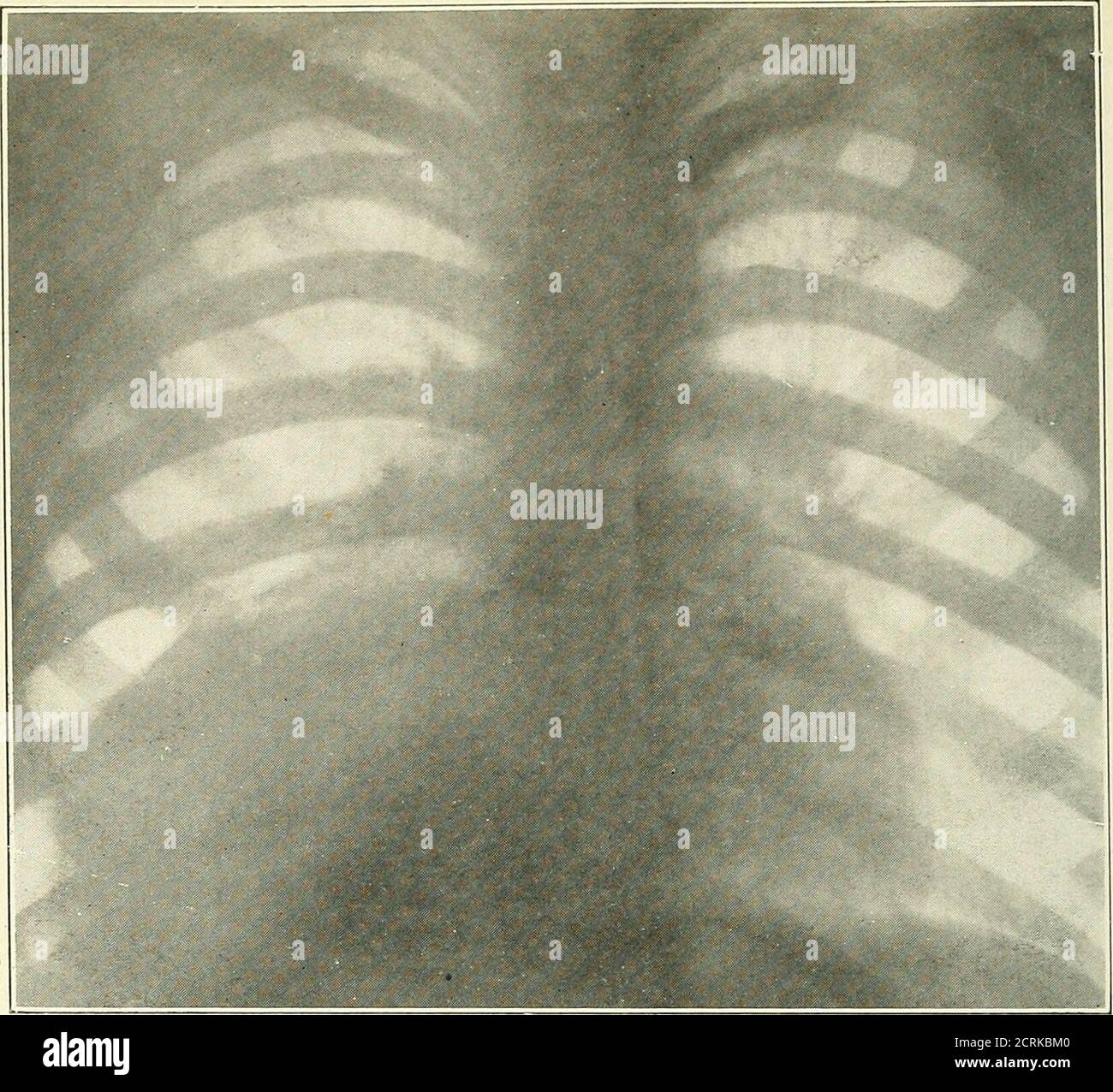 Diffuse process hi-res stock photography and images - Alamy