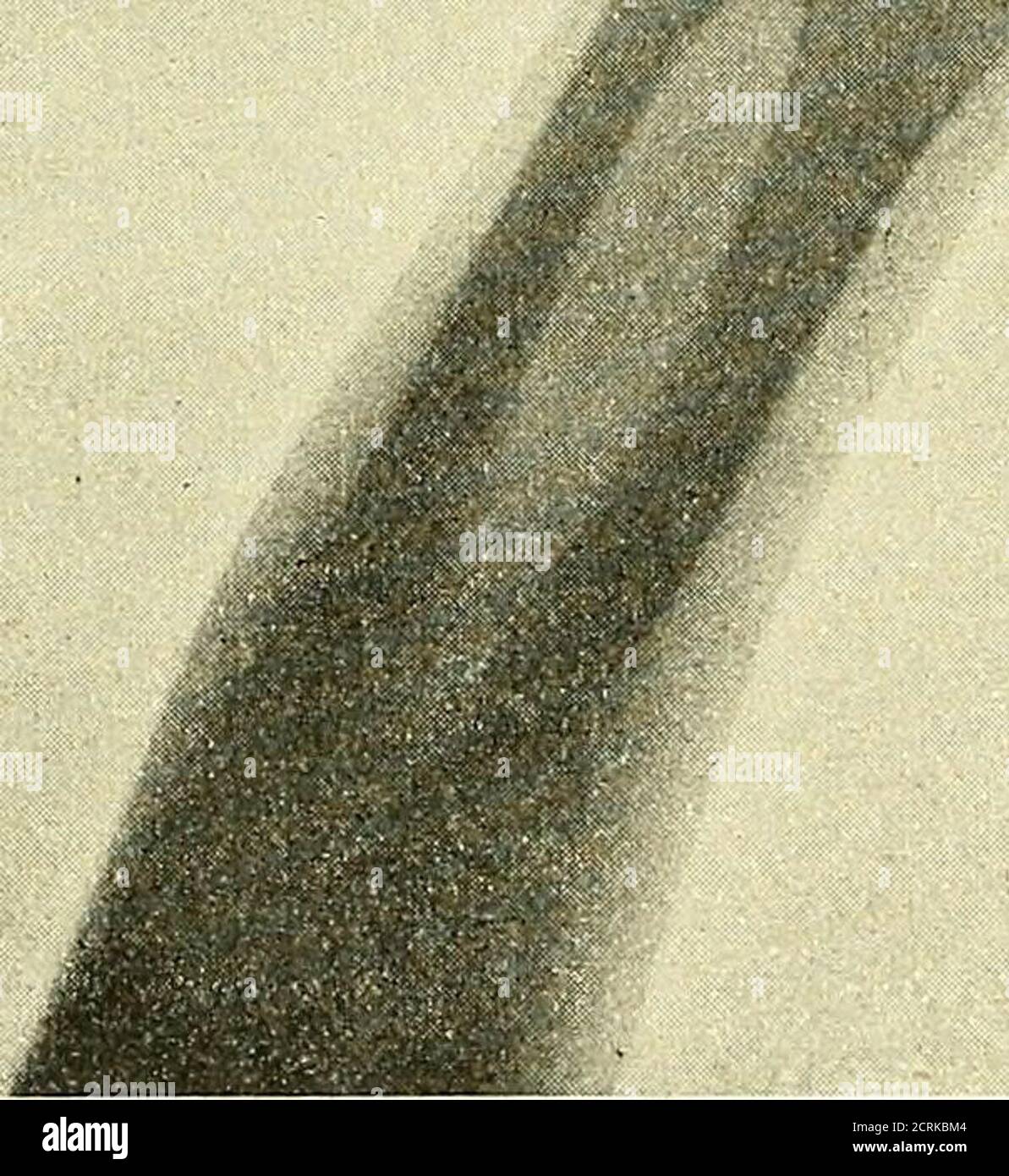 Fusswurzelknochen hi-res stock photography and images - Alamy