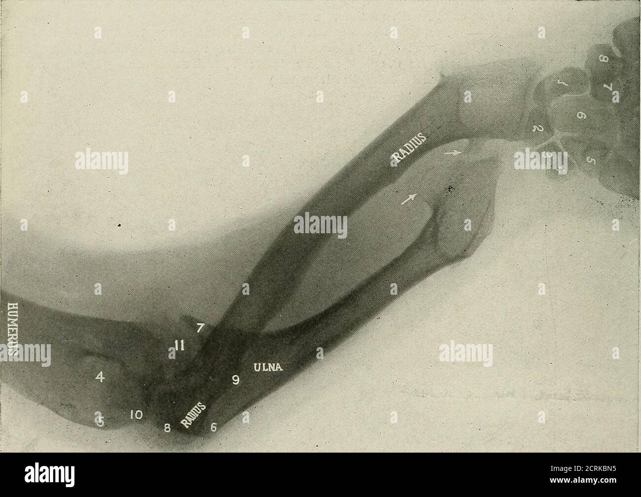 . Röntgen rays and electro-therapeutics : with chapters on radium and ...