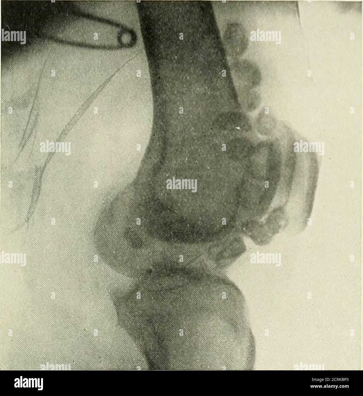 . Radiography, x-ray therapeutics and radium therapy Stock Photo - Alamy