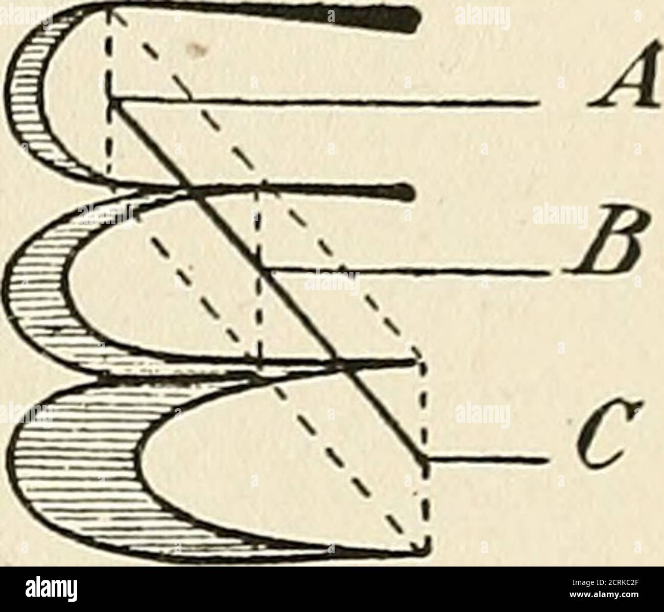 . Radio-diagnosis of pleuro-pulmonary affection . FiG. 6. EXPLANATION ...