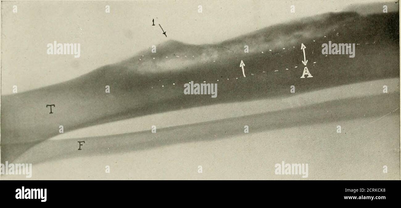 . Röntgen rays and electro-therapeutics : with chapters on radium and ...