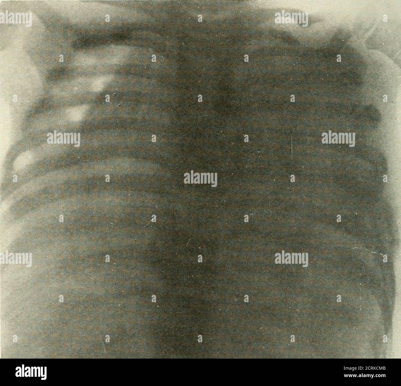 . Roentgen interpretation; a manual for students and practitioners ...