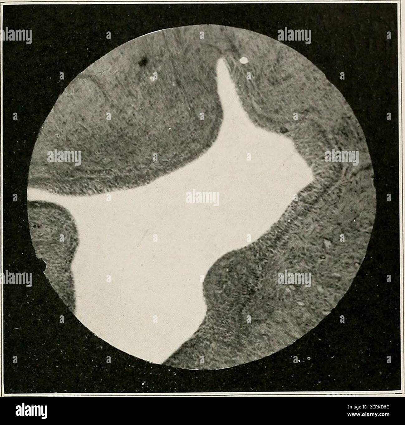 Alveolar Process What Is The Alveolar Bone And What Is Its Function?