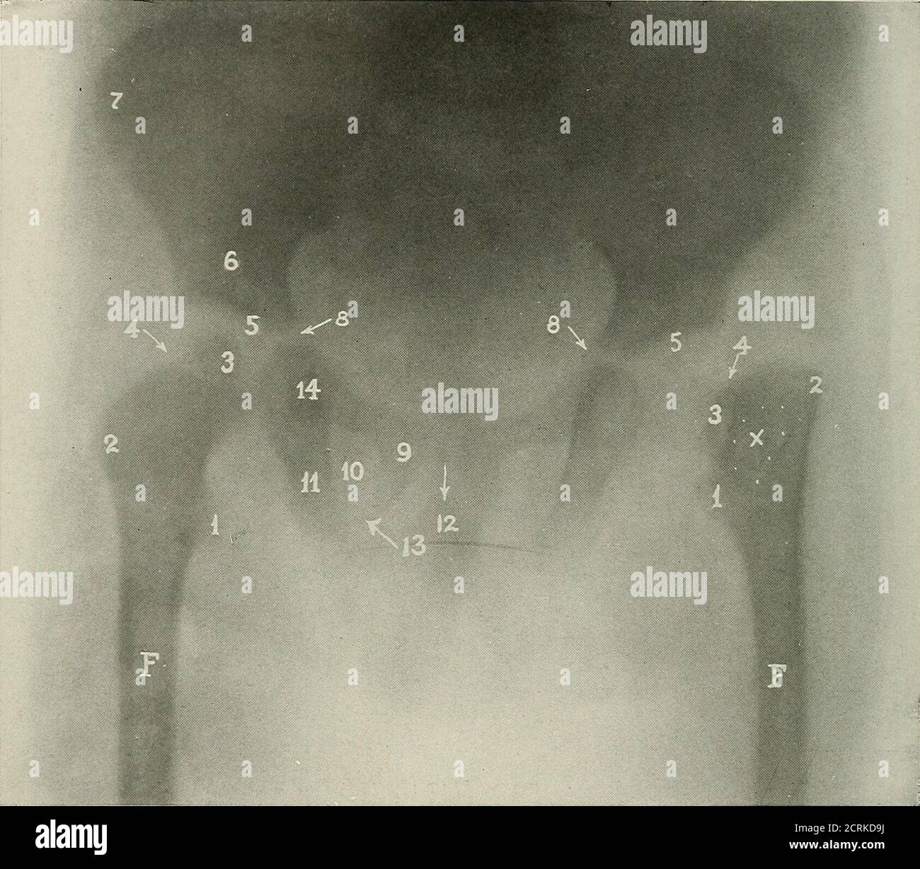. Röntgen rays and electro-therapeutics : with chapters on radium and ...