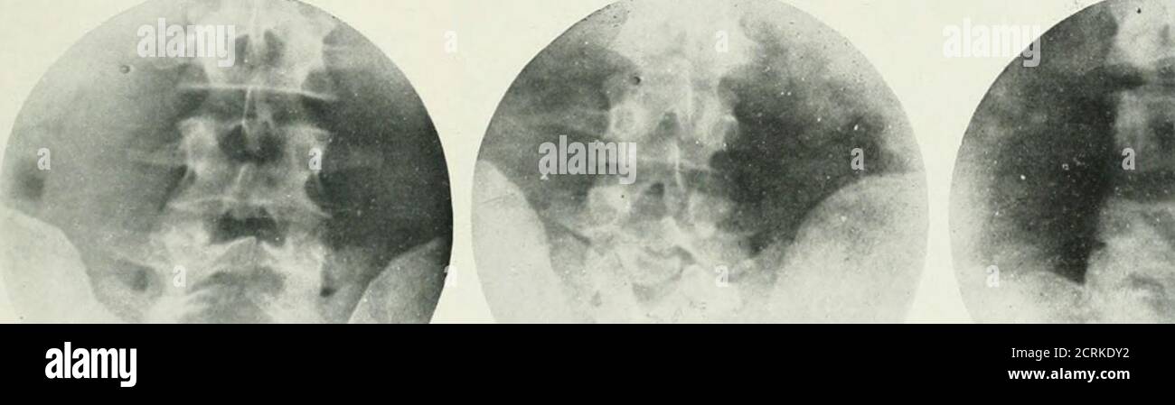 . Archives of physical medicine and rehabilitation . 6 (A2727S3). Spina ...