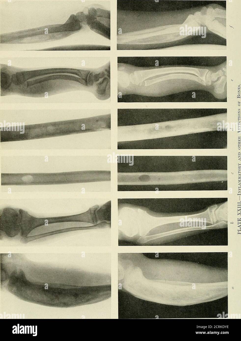 Respect radiography hi-res stock photography and images - Alamy