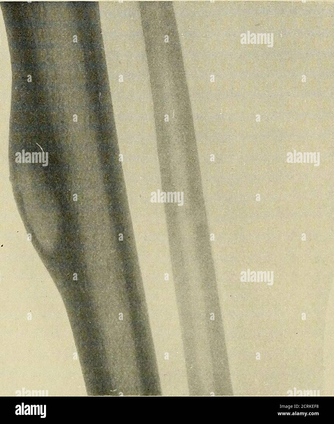 . Radiography, x-ray therapeutics and radium therapy . erate, and ...