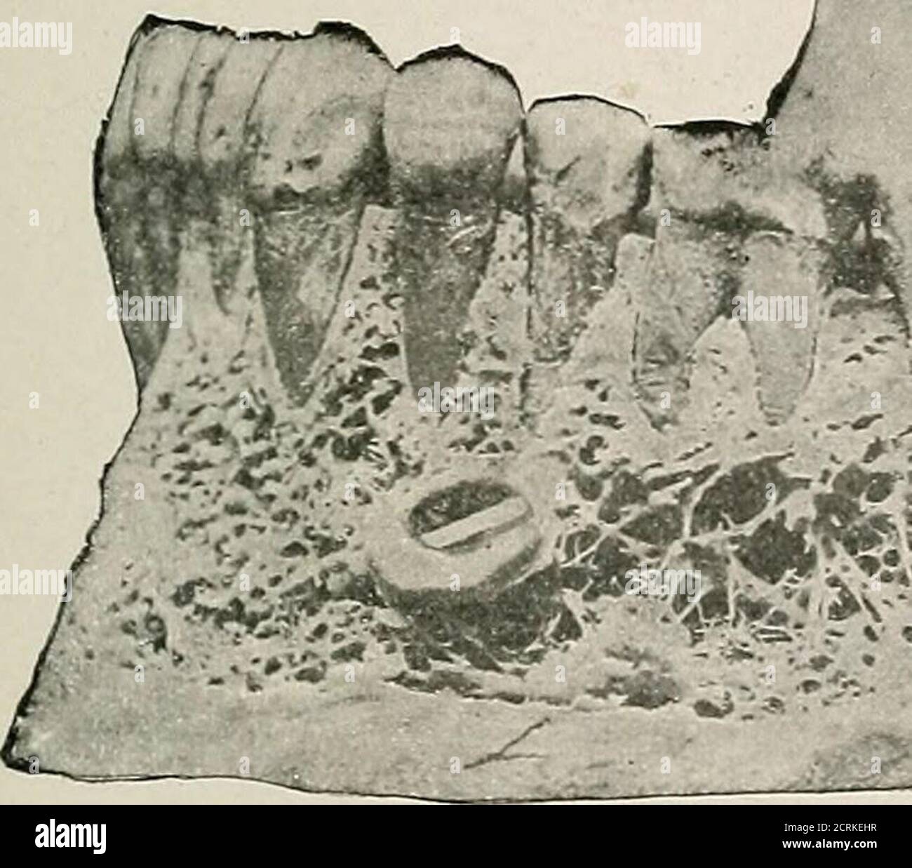 . Interpretation of dental and maxillary roentgenograms . Fig. 8 ...