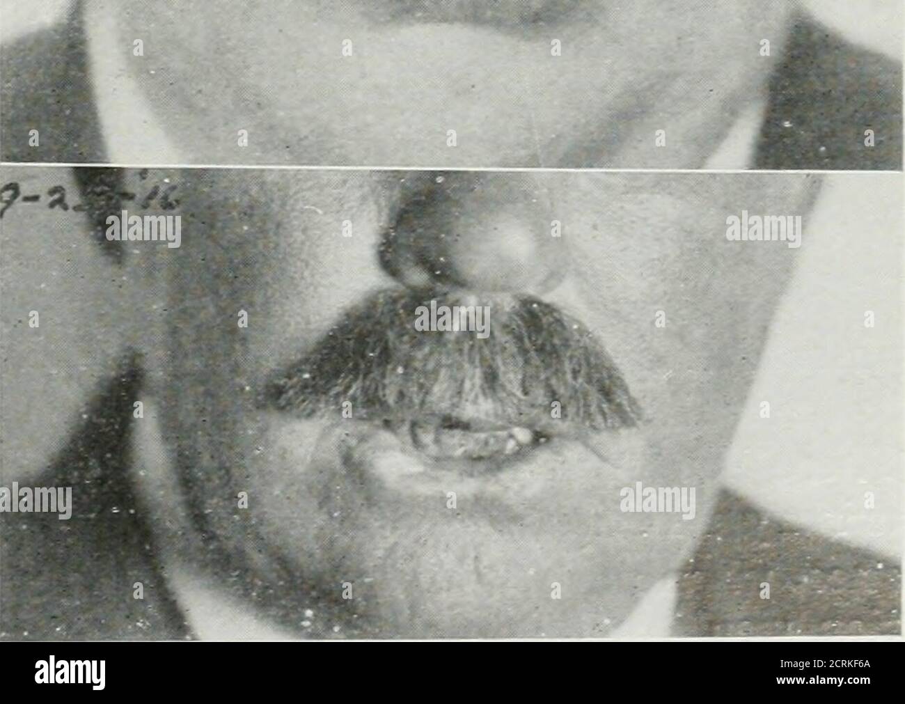 Negative 1917 hi-res stock photography and images - Alamy